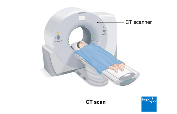 Mouth Cancer | Teodora Todorova